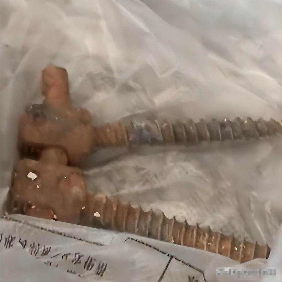 婆婆火化後骨灰「多出4顆鋼釘」，兒媳「她根本沒動過手術」...調閱監控1驚人發現：所有人都沉默了 - agonew