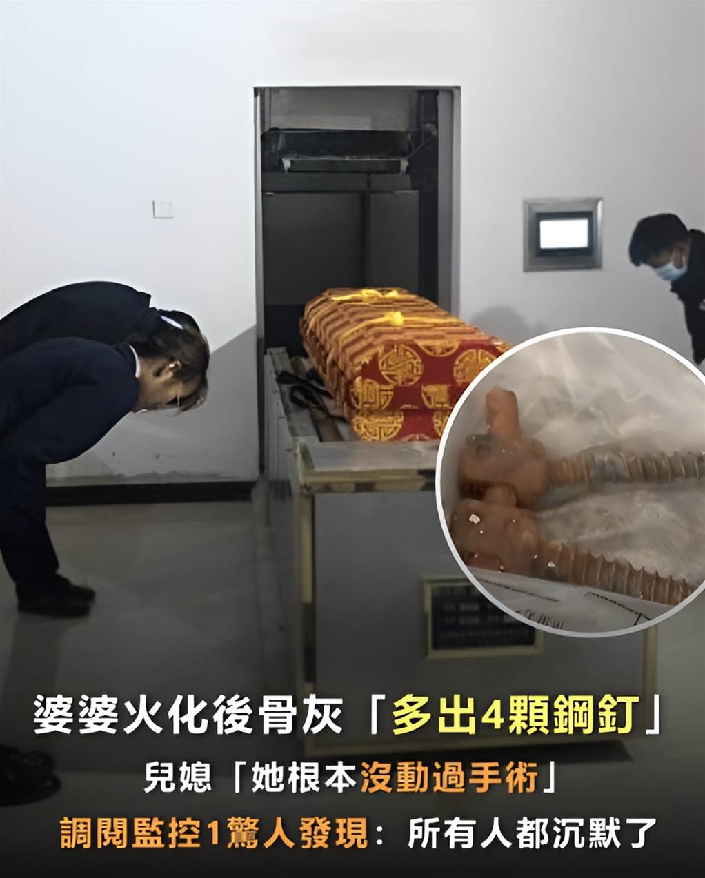 婆婆火化後骨灰「多出4顆鋼釘」，兒媳「她根本沒動過手術」...調閱監控1驚人發現：所有人都沉默了 - agonew
